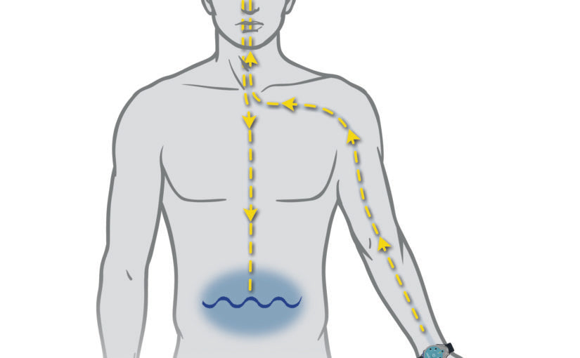 How Reliefband Works